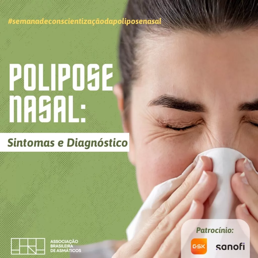 Quais são os sintomas da Polipose Nasal? - ABRA